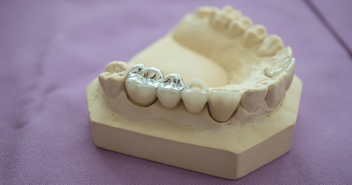 Safely Removing Mercury Amalgam Fillings the SMART Way | HCD